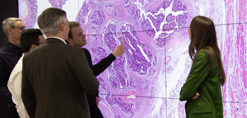AI cancer research receives £5.1m data funding boost - Yorkshire ...